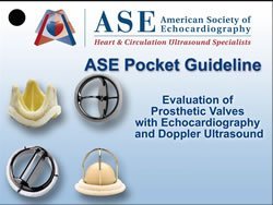 Evaluation of Prosthetic Valves with Echocardiography and Doppler ...