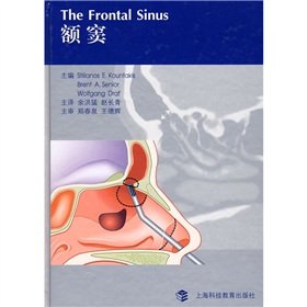 Frontal sinus(Chinese Edition): KAO TA KE SI: 9787542843470: Amazon.com ...