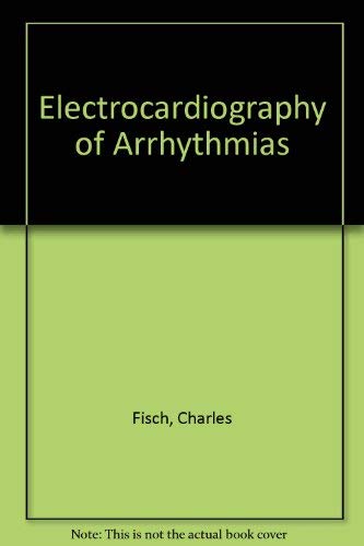 Electrocardiography of Arrhythmias: 9780812112658: Medicine & Health ...