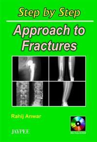 Step By Step Approach to Fractures Rahij Anwar : Amazon.com.tr: Kitap