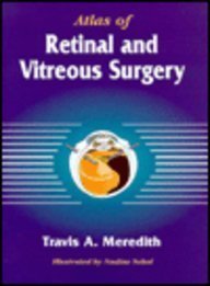 Atlas Of Retinal And Vitreous Surgery: 9780815128342: Medicine & Health ...