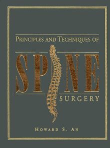 Principles and Techniques of Spine Surgery: 9780683302608: Medicine ...
