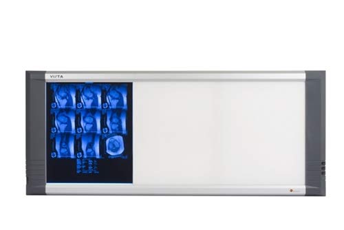 10 Best Radiology Illuminators 2023 – Reviews & Ratings
