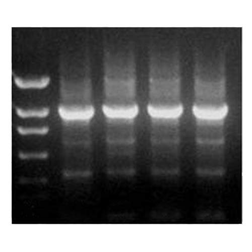 Amazon.com: ACTGene E2000-250U Actaq High Fidelity DNA Polymerase ...