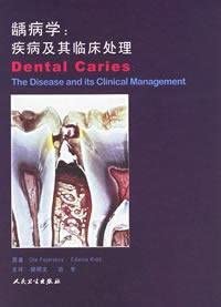 Dental caries: () YUAN ZHU Ole Fejerskov. () Edwina Kidd: 9787117073394 ...