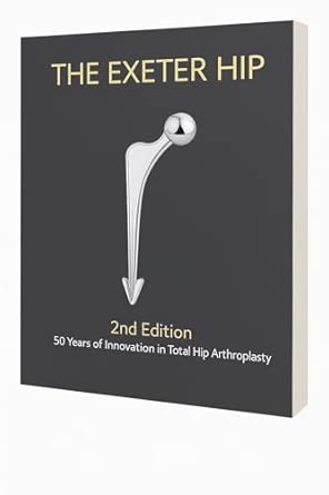 Buy The Exeter Hip: 50 Years of Innovation in Total Hip Arthroplasty ...