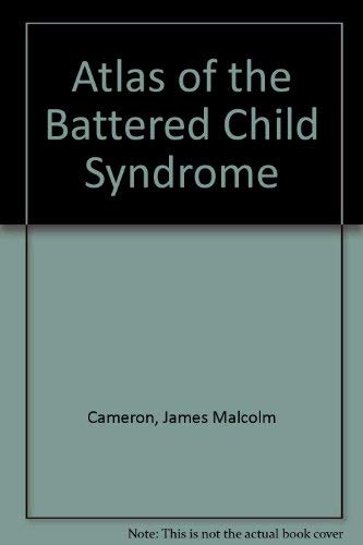 Atlas of the battered child syndrome: Cameron, J. M: 9780443012532 ...