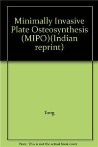 Minimally Invasive Plate Osteosynthesis (MIPO)(Ind | Amazon.com.br