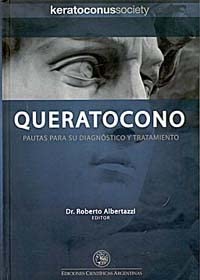 Queratocomo:pautas para Su Diagnostico y Tratamiento : Amazon.es: Libros