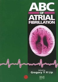 Amazon | ABC of Atrial Fibrillation (ABC Series) | Lip, Gregory Y. H ...
