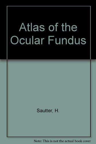 Atlas of the Ocular Fundus (English and German Edition): 9780806718736 ...