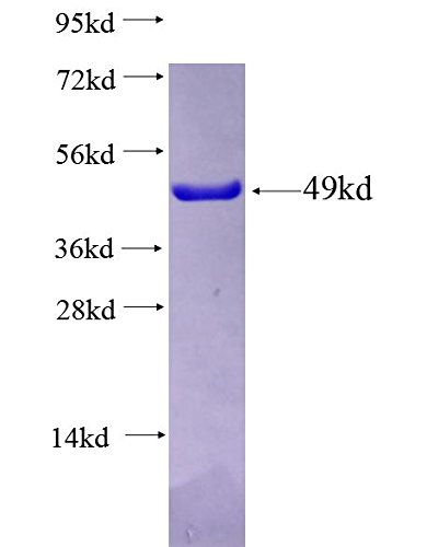Amazon.com: Human RAB1A Fusion Protein : Industrial & Scientific