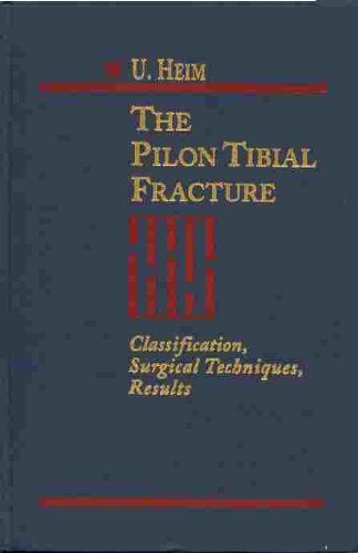 The Pilon Tibial Fracture: Classification, Surgical Techniques, Results ...