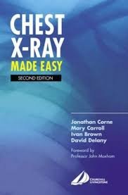 Chest X-Ray Made Easy: Professor John Moxham: 9780443070099: Amazon.com ...