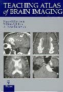 Teaching atlas of brain imaging: Fischbein, Nancy: 9783131163417 ...