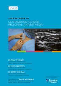 Buy A Pocket Guide to Ultrasound Guided Regional Anaesthesia Book ...