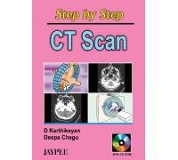 Step by Step CT Scan with CD-ROM : Amazon.in: Books