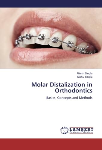Molar Distalization in Orthodontics: Basics, Concepts and Methods ...