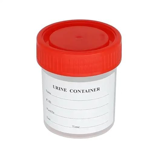 Polypropylene Urine Sample Bottles 30ml With Lid Pack of 20pcs for ...