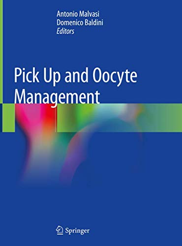 Pick Up and Oocyte Management | Amazon price tracker / tracking, Amazon ...
