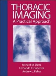 Thoracic Imaging: A Practical Approach: 9780070582231: Medicine ...