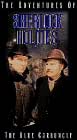 The Adventures of Sherlock Holmes: The Blue Carbuncle [Import] : Amazon ...