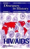 HIV/AIDS (Diseases in History): Cunningham, Kevin: 9781599351049 ...