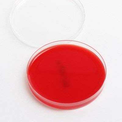 P5010 - Anaerobic Blood Agar (CDC), 15 mm x 100 mm Standard Petri Dish ...