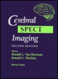 Cerebral Spect Imaging: 9780781701884: Medicine & Health Science Books ...