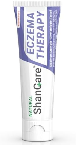 Amazon.com: ishancare Urticaria Cream, Fast Acting Relief of Hives ...