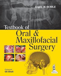 Textbook of Oral and Maxillofacial Surgery: Rajiv M Borle ...
