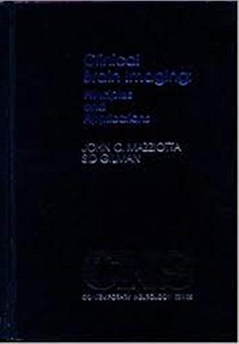 Clinical Brain Imaging: Principles and Applications (Contemporary ...