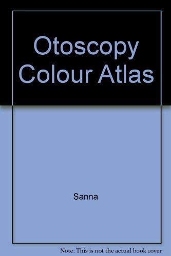 Color Atlas of Otoscopy: From Diagnosis to Surgery: 9780865777217 ...