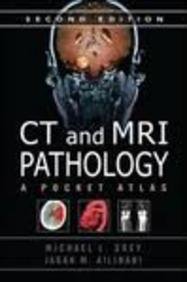 CT and MRI Pathology : A Pocket Atlas : GREY: Amazon.in: Books