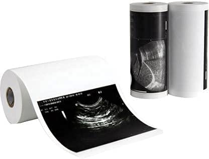 RK Ultrasound Thermal Printer Paper Rolls 110S 110mm*20 meter (Set of 5 ...