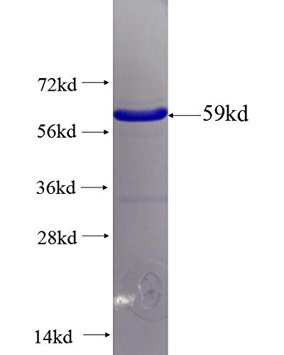 Amazon.com: Human GGH Fusion Protein : Industrial & Scientific
