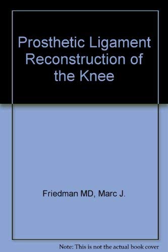 Prosthetic Ligament Reconstruction of the Knee: 9780721625591: Medicine ...