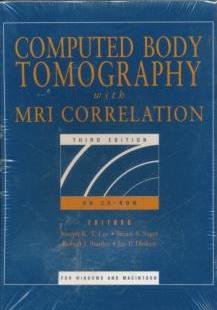 Computed Body Tomography With Mri Correlation: Lee, Joseph K. T ...