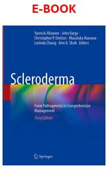 Scleroderma. From Pathogenesis to Comprehensive Management (e-book ...
