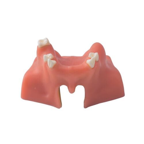 Amazon.com: Dental Maxillary Sinus Lifting Practice Model Implant Upper ...
