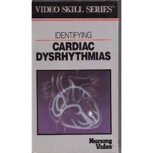 Identifying Cardiac Dysrhythmias: Springhouse Corporation ...
