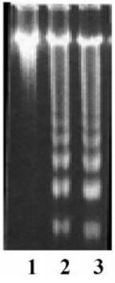 Amazon.com: Quick DNA Ladder Apoptosis Detection Kit : Industrial ...