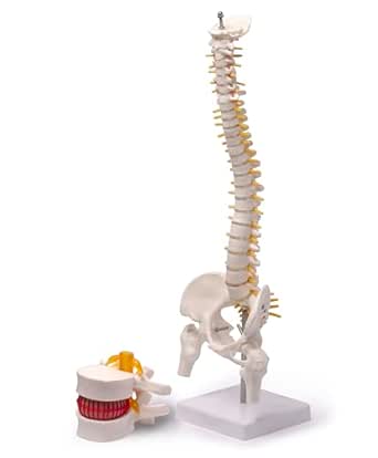 Myaskro Lumbar Spine Herniation Disc Model With 45cm Tall Human Spine ...
