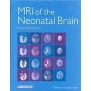 MRI of the Neonatal Brain : Rutherford, Mary: Amazon.ca: Livres