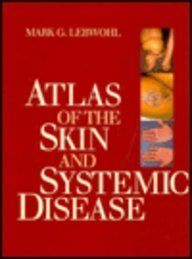 Atlas of the Skin and Systemic Disease: A Color Atlas and Text ...