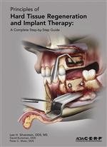 Principles of Hard Tissue Regeneration and Implant Surgery: A Complete ...