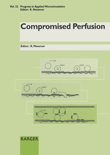 Compromised Perfusion (PROGRESS IN APPLIED MICROCIRCULATION ...