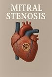 Mitral Stenosis: a progressive narrowing of the mitral valve, remains a ...