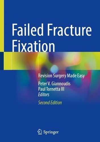Failed Fracture Fixation: Revision Surgery Made Easy: Giannoudis, Peter ...