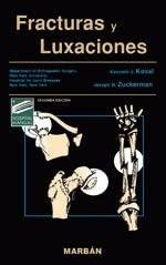 Fracturas y Luxaciones : Koval, Kenneth J, Zuckerman, Joseph: Amazon ...